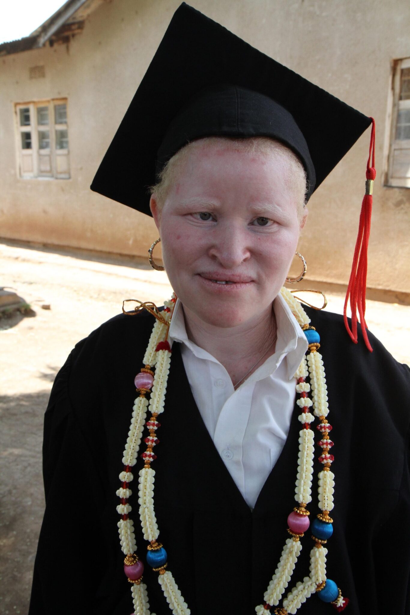 Meet Mariamu | Albinism Stories | Under the Same Sun