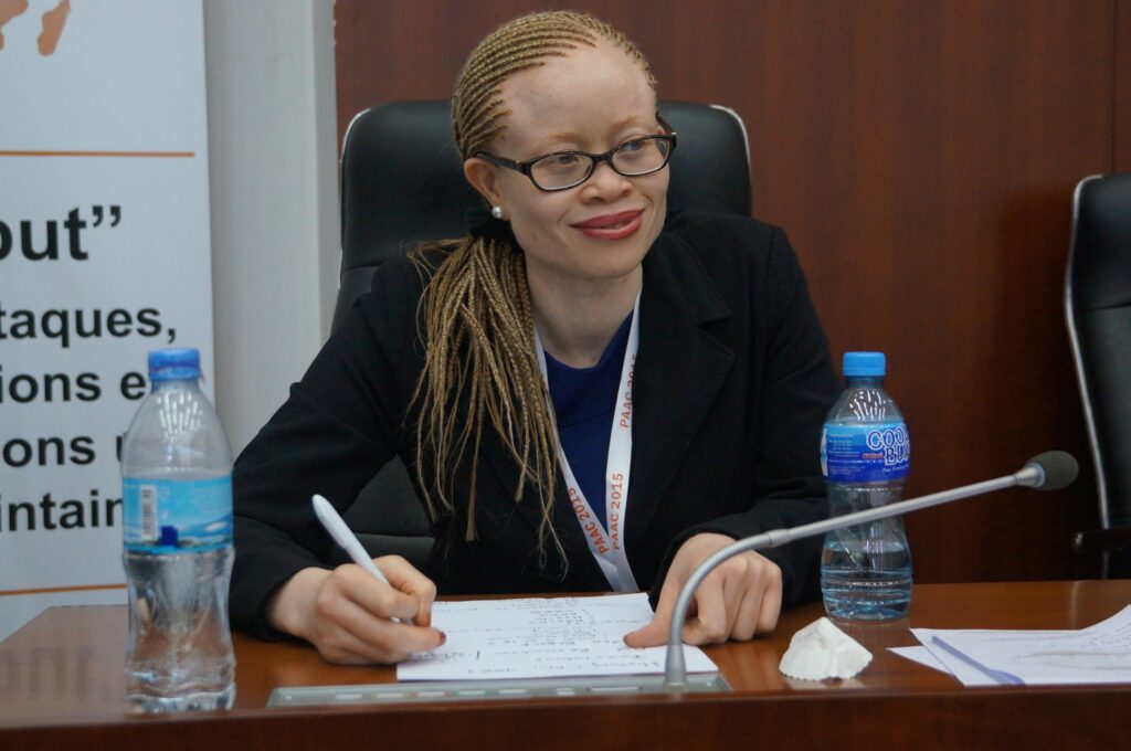 Albinism Advocacy | Under the Same Sun