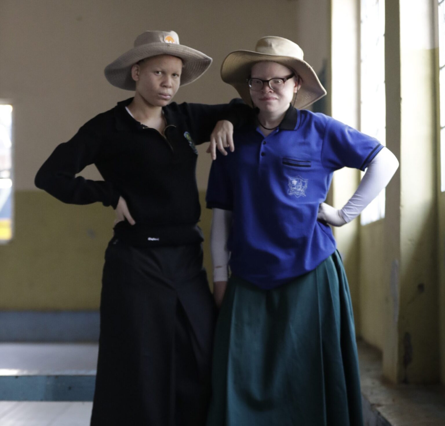 Under the Same Sun | Helping People with Albinism