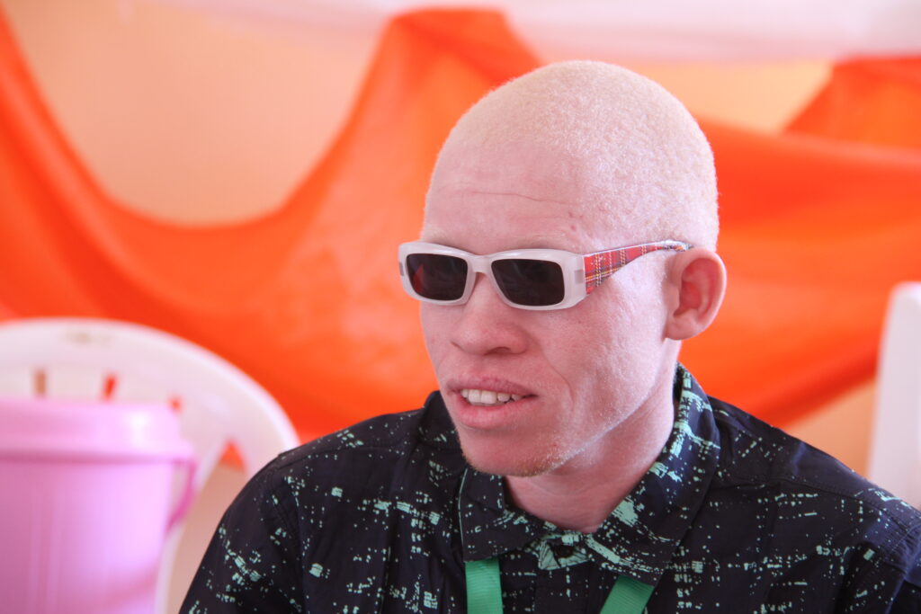 A Place to Belong - Dalali's Story | Albinism Stories | Under the Same Sun