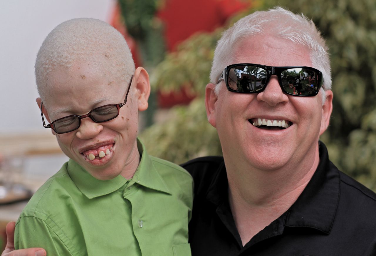 Manyashi's Journey | Albinism Newsletter, Stories | Under the Same Sun