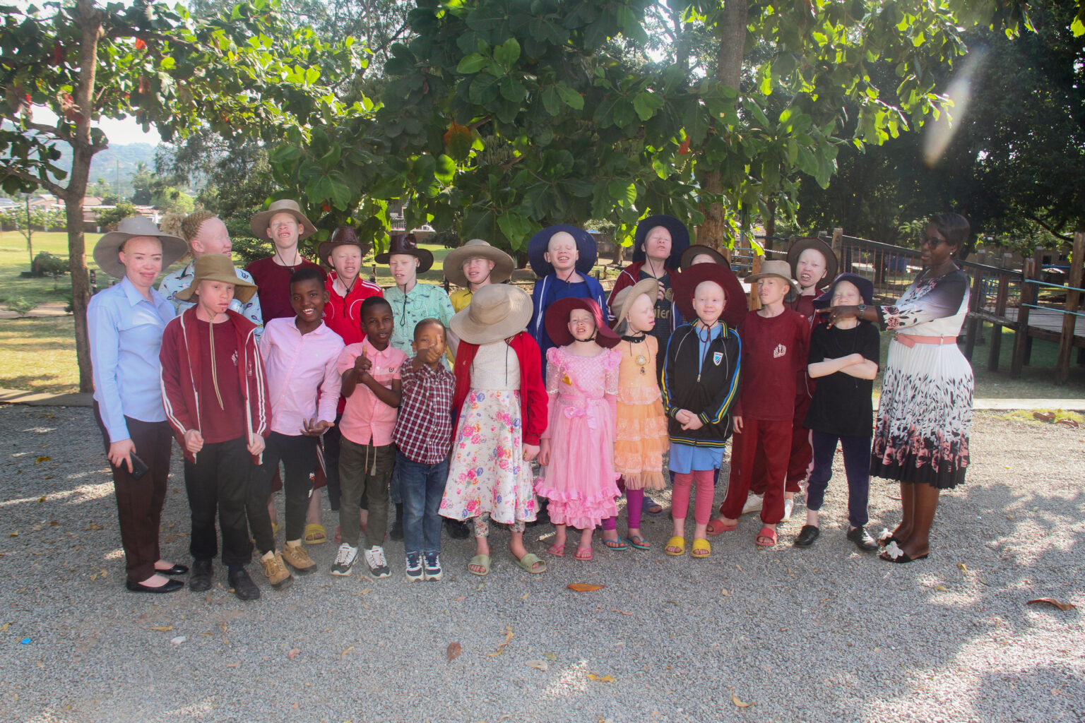 Under the Same Sun | Helping People with Albinism